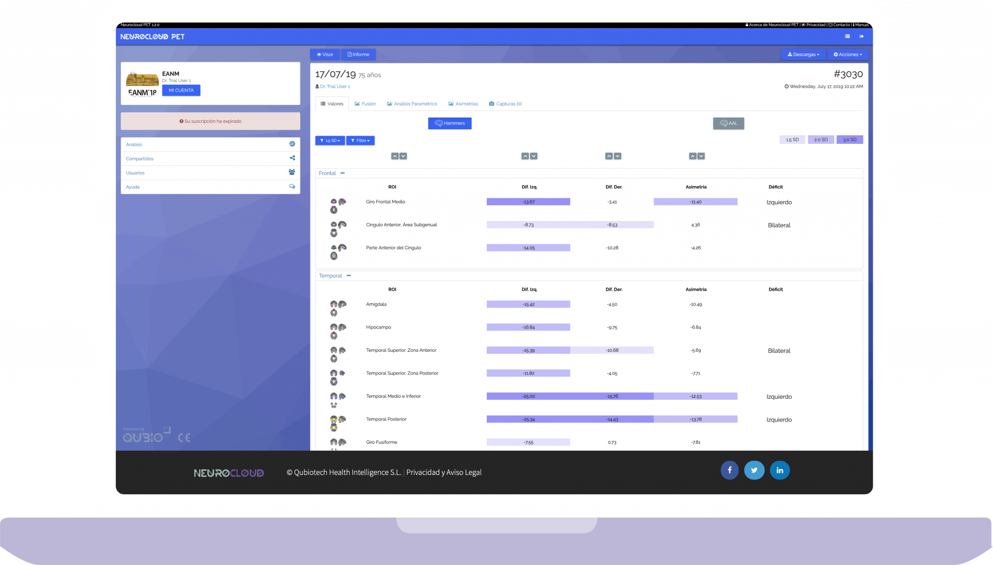 Qubiotech | Bienvenido a la neuroimagen aumentada