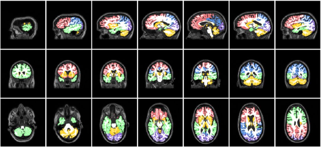 Qubiotech | Neurocloud VOL