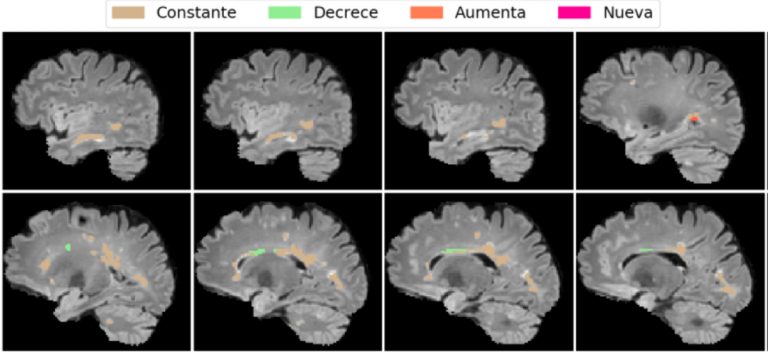 Qubiotech | Neurocloud VOL