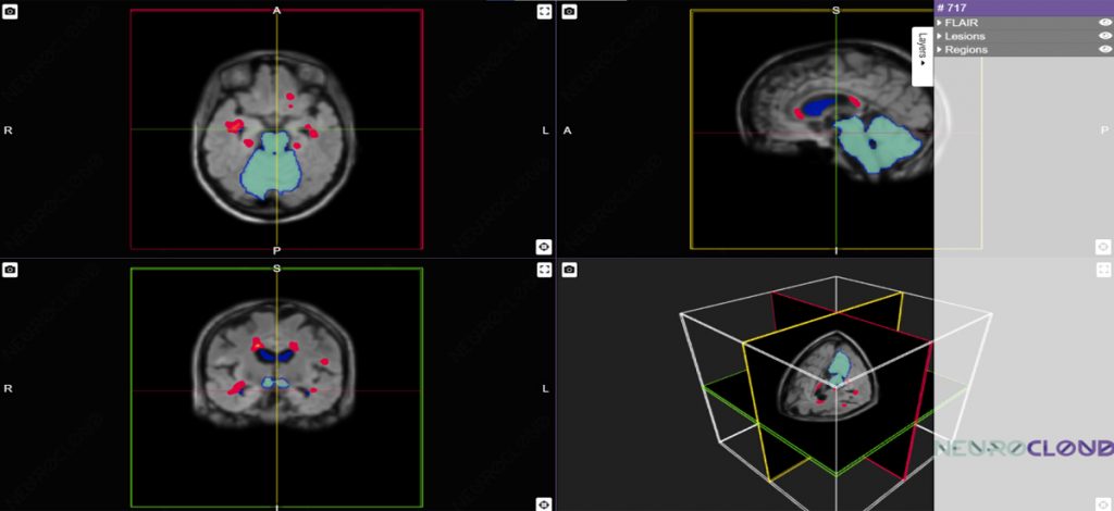 Qubiotech | Neurocloud VOL