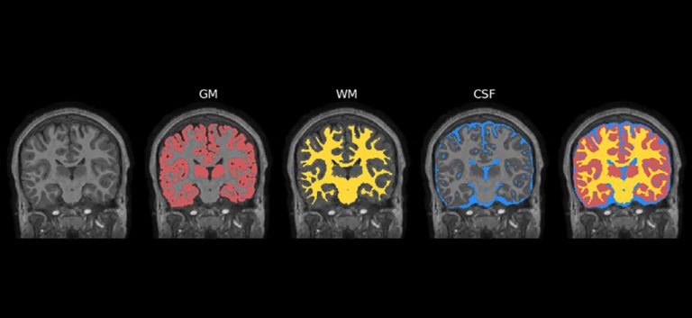 Qubiotech | Neurocloud VOL