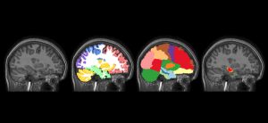 Qubiotech | Neurocloud VOL