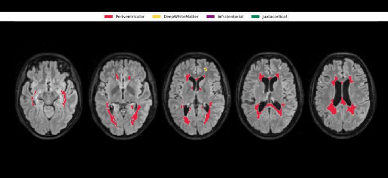 Qubiotech | Neurocloud VOL
