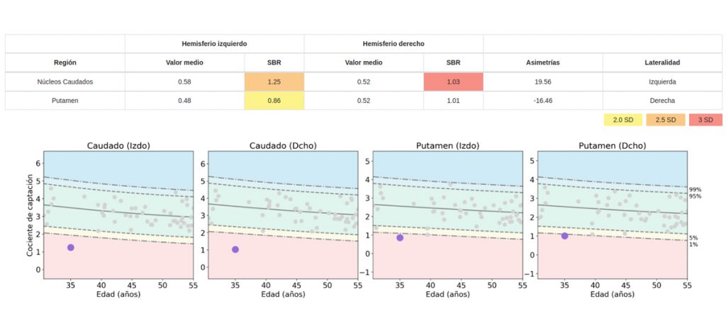 Qubiotech | Neurocloud SPECT