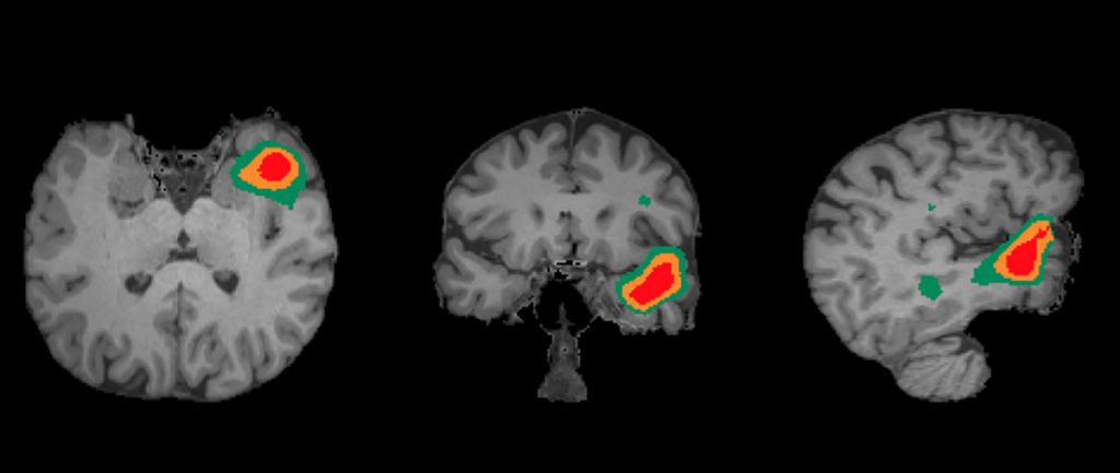 Qubiotech | Neurocloud SISCOM