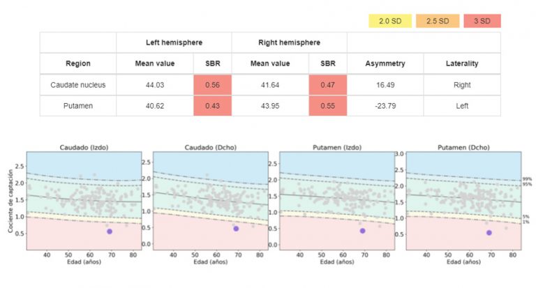 Qubiotech | Neurocloud SPECT